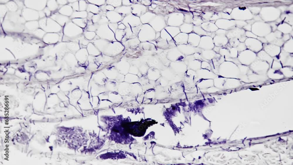 Skin section through hair follicle filmed under microscope 200x on ...