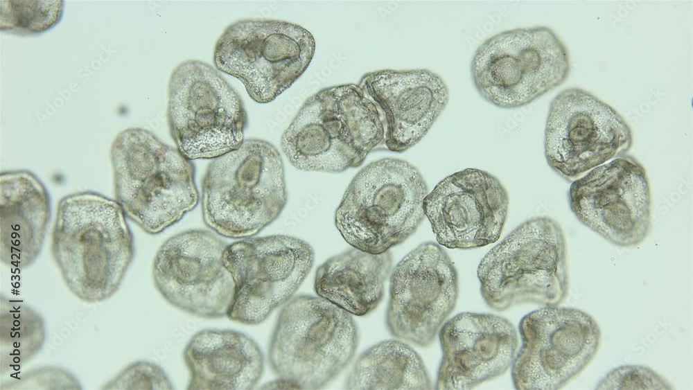 Larvae sea urchin Strongylocentrotus pallidus under microscope, phylum ...