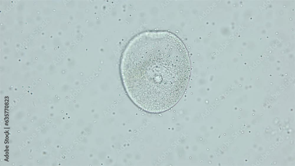 Video „Sperm and ovule of worm Polychaeta Ophelia limacina under ...