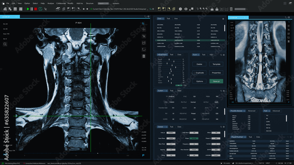 3D Render: Magnetic Resonance Imaging Spinal Cord Scan Mock-up with ...