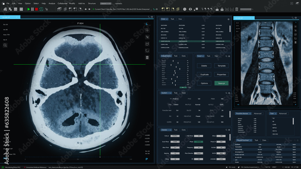 3D Render: Magnetic Resonance Imaging Brain and Spinal Cord Scan Mock ...