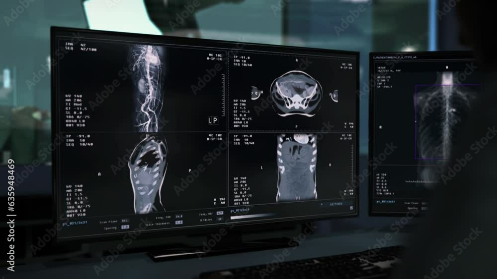 Multiple Diagnostic Anatomical Examination Screens Inspecting Internal ...