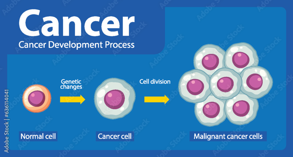 Processing of Cancer Cells: An Infographic Exploration Stock Vector ...