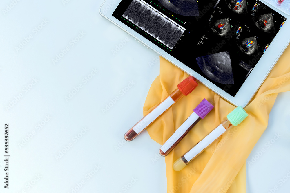 Poster Patient cardiac activity is being monitored on an ...