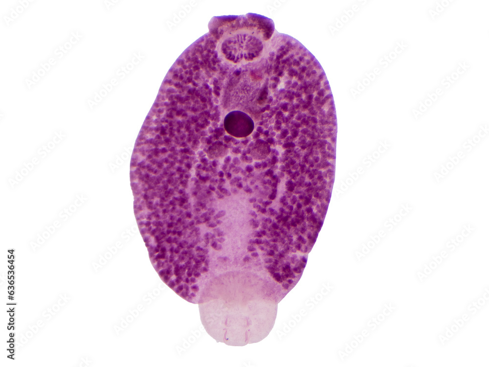 Flukes infestation (parasite) under microscope view. Stock Photo ...