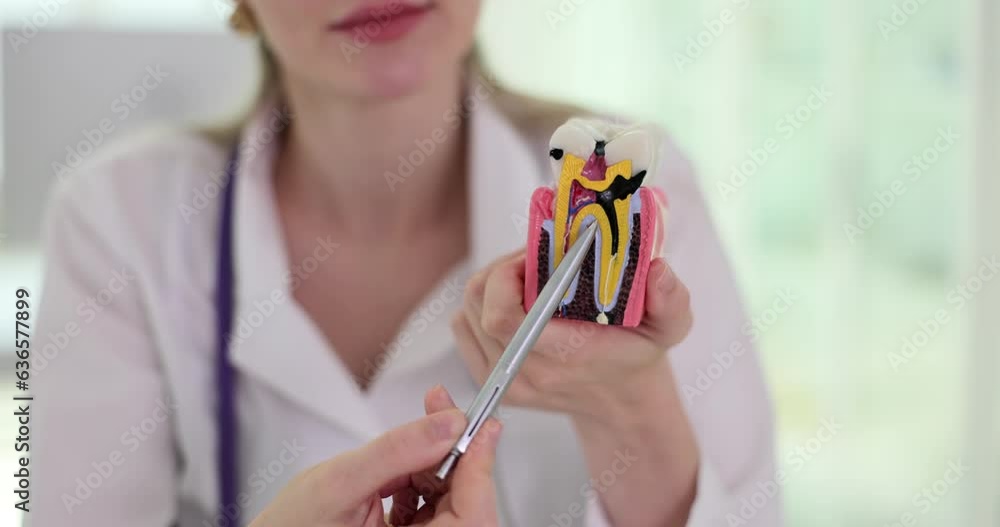 Dentist showing model of artificial tooth in examination room. Doctor ...