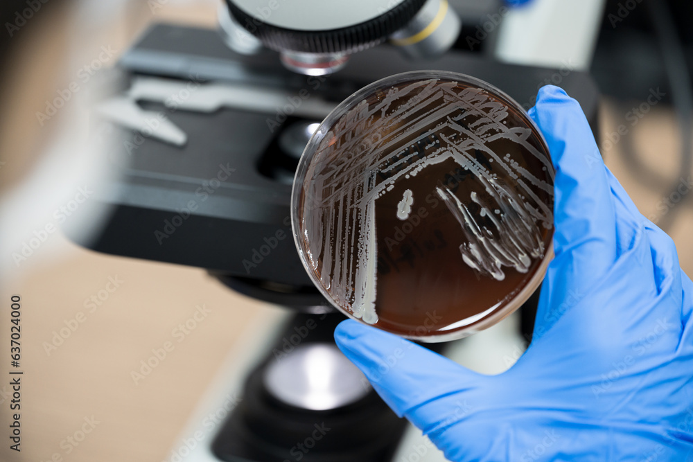 Scientist holding agar plate for diagnosis bacterial or microorganism ...