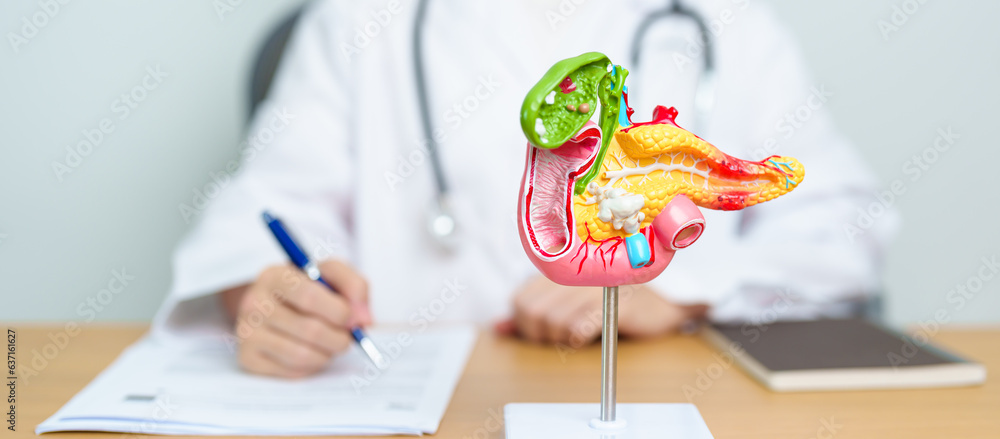 Doctor with human Pancreatitis anatomy model with Pancreas, Gallbladder ...