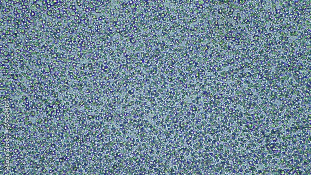 Breast milk under the microscope, woman lactating milk Feeding a baby ...