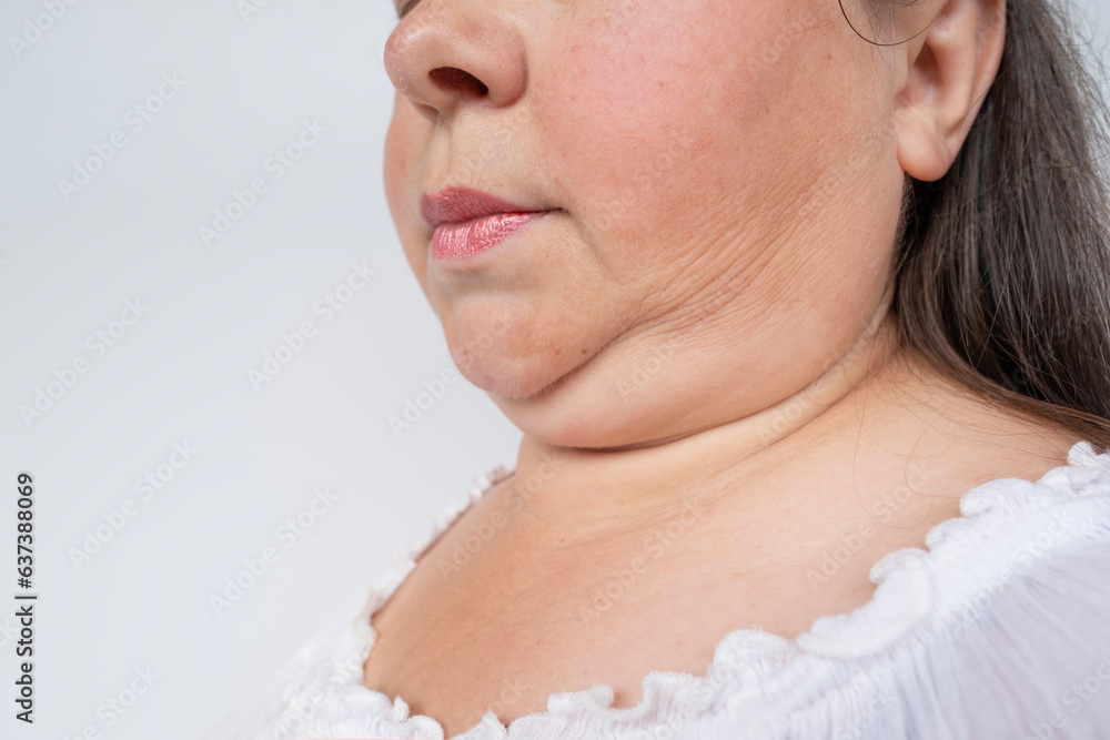 Double chin face mature woman 50 years old, human fat neck, side view ...