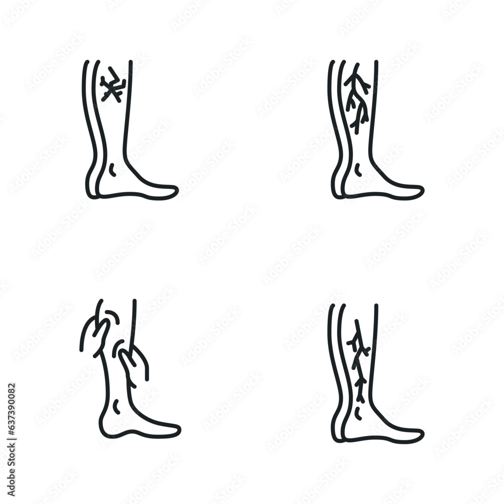 Varicose treatment icons, leg veins thrombosis disease and surgery ...