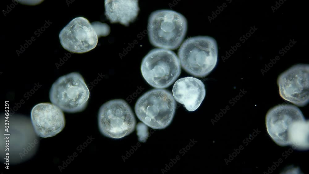 Stockvideon Larvae sea urchin Strongylocentrotus pallidus under ...