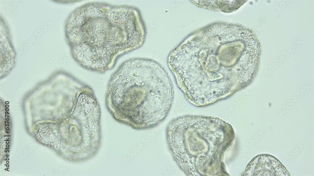 Larvae sea urchin Strongylocentrotus pallidus under microscope, phylum ...