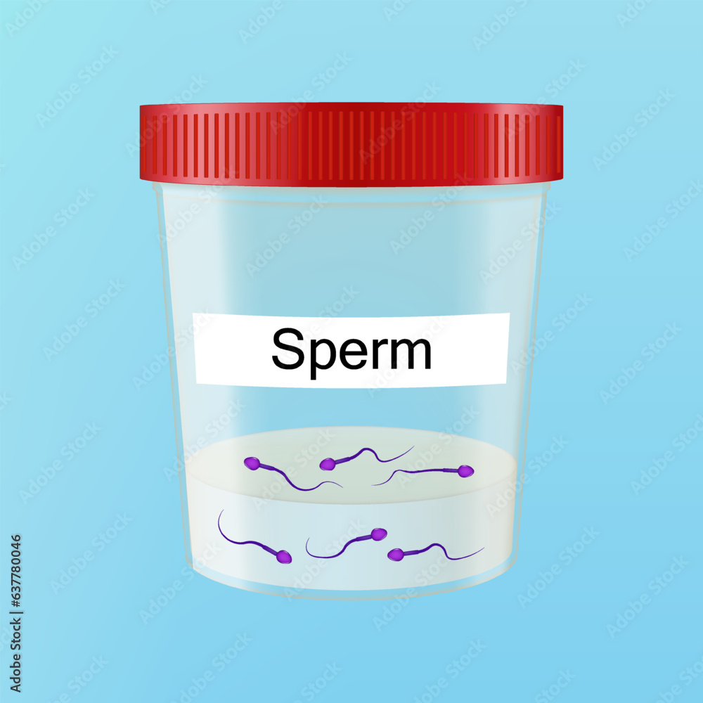 Semen analysis vector. Medical Sample in Glass Tube. Sample sperm ...