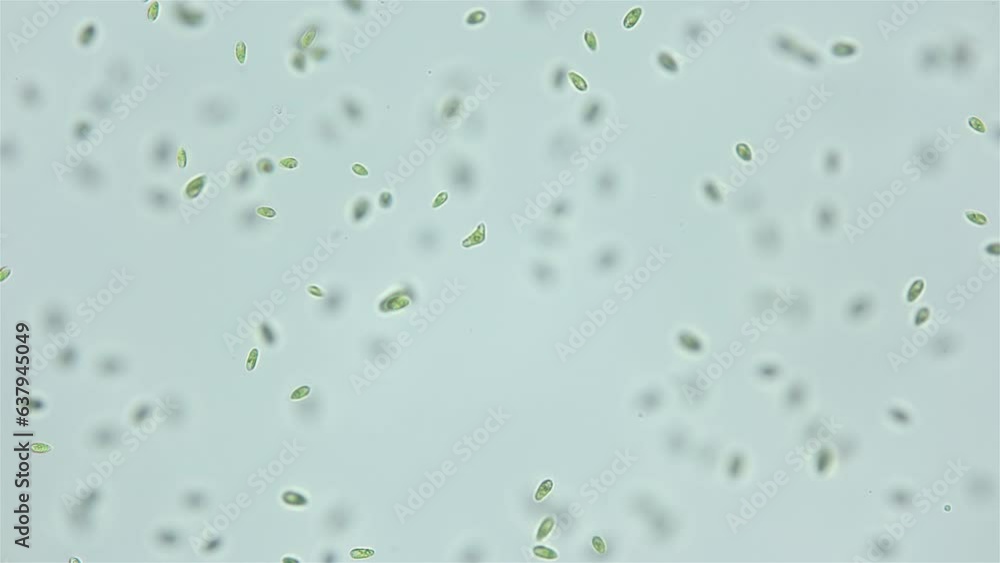 Unicellular algae Dunaliella salina under the microscope, Chlorophyta ...