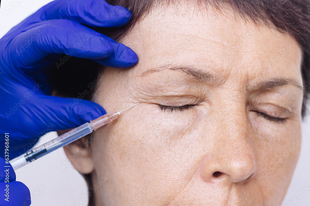 Doctor in blue gloves injecting fillers into facial wrinkles near eyes ...