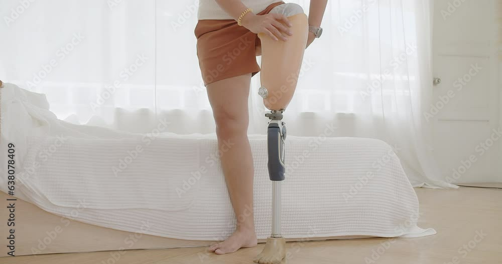 Happy Disabled Asian woman amputee walking take a rest and takes off removing prosthetic leg ...