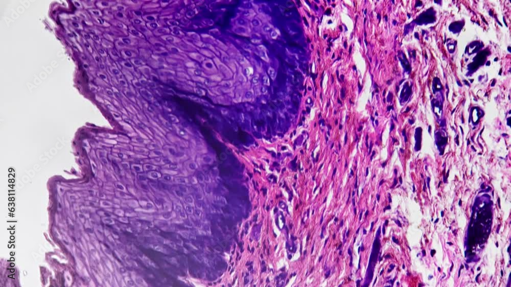 Human penis in cross section filmed under microscope 200x against ...