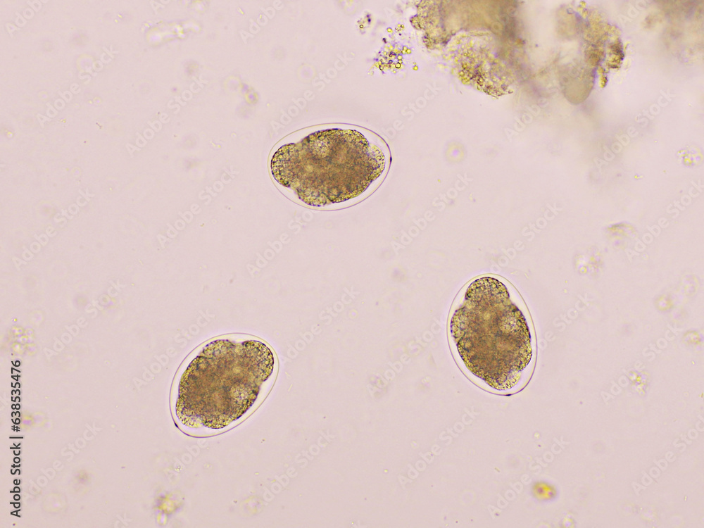 Egg of Hookworm in human stool, analyze by microscope, original ...