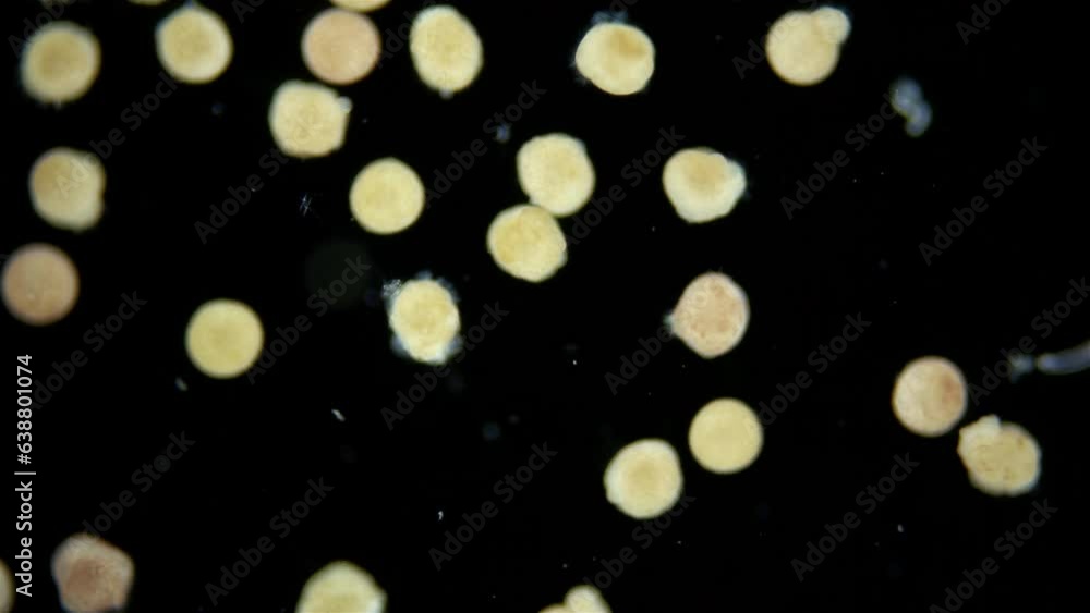 Larvae of sea snail Testudinalia testudinalis under microscope, family ...