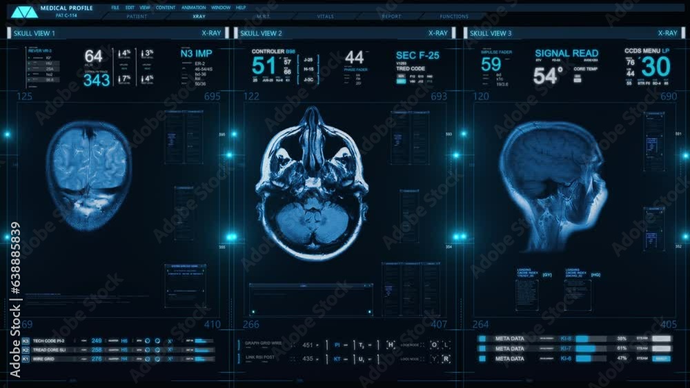 Futuristic Technological Interface Analyzing Human Brain Anatomy and ...