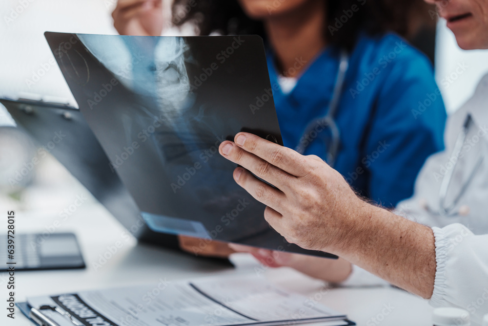 Medical staff team african american meeting discussing chest x-ray film ...