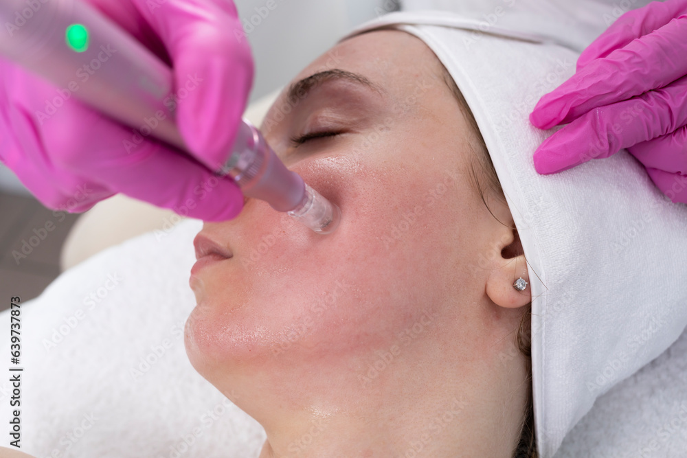 Closeup Cosmetologist Making Mesotherapy Injection With Dermapen On ...