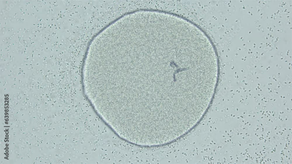 Sperm and ovule sea urchin Strongylocentrotus pallidus under microscope ...