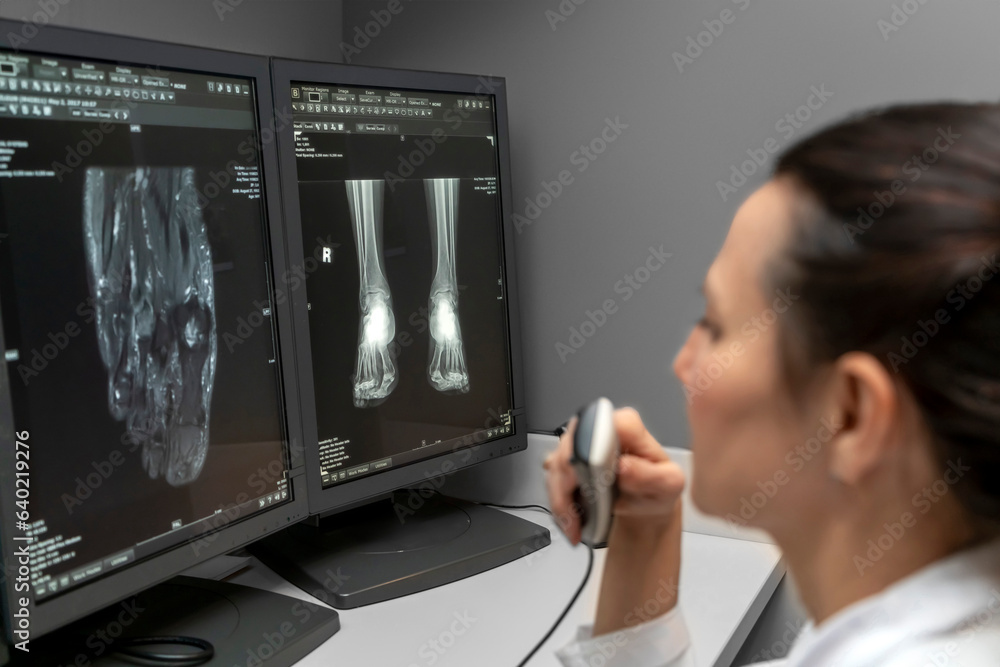 radiology doctor examines foot, ankle x-ray, mr image and reports with ... radiology doctor examines foot, ankle x-ray, mr image and reports with ...