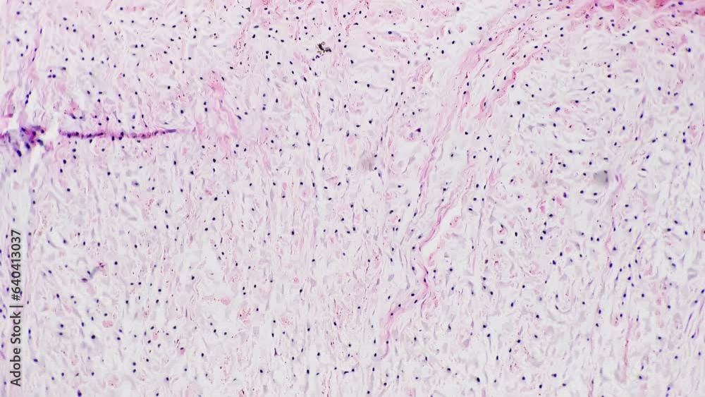 Dense connective tissue of human whole mount filmed under microscope ...