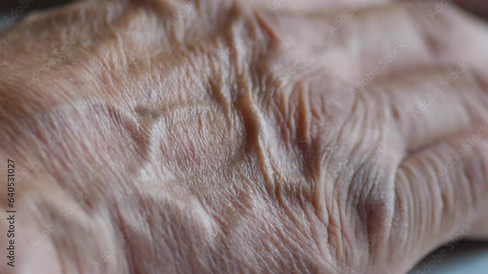 close-up of a pensioner's hand with wrinkles and veins. senile skin on ...