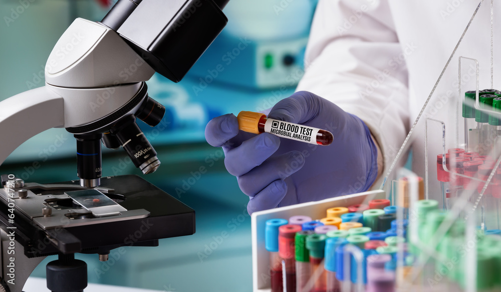 Hematologist in the laboratory looking for signs of disease or ...