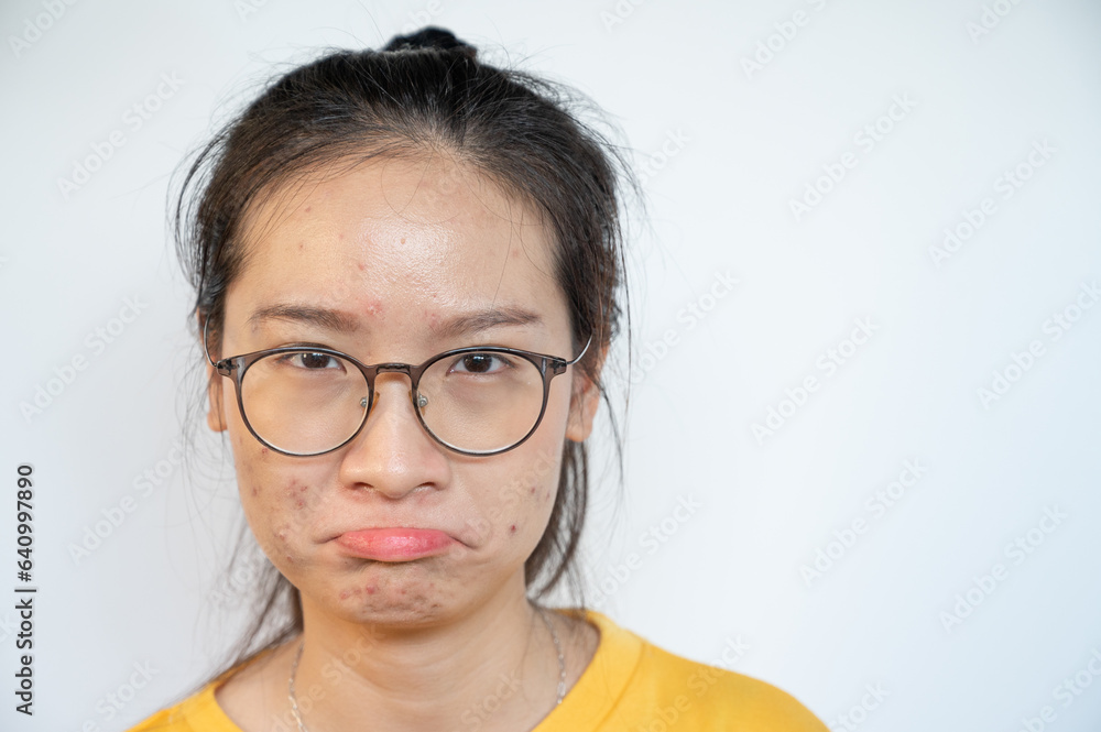 Unconfident Asian woman having acne problem with isolated background ...