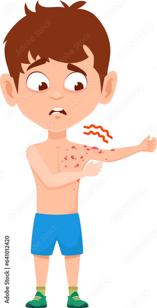Child with skin rash disease. Isolated vector sick boy with itchy red ...