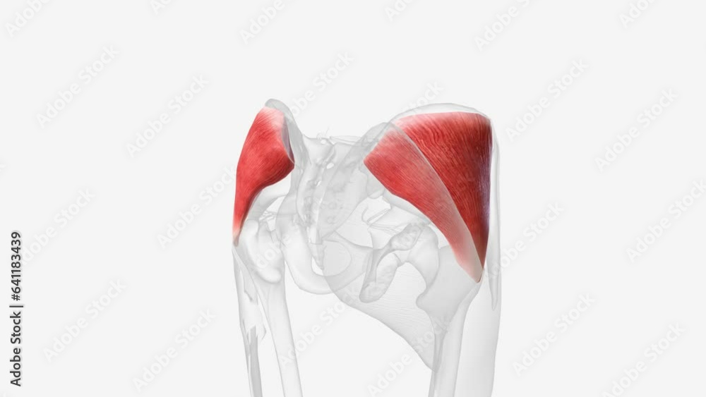 The gluteus medius, one of the three gluteal muscles, is a broad, thick ...
