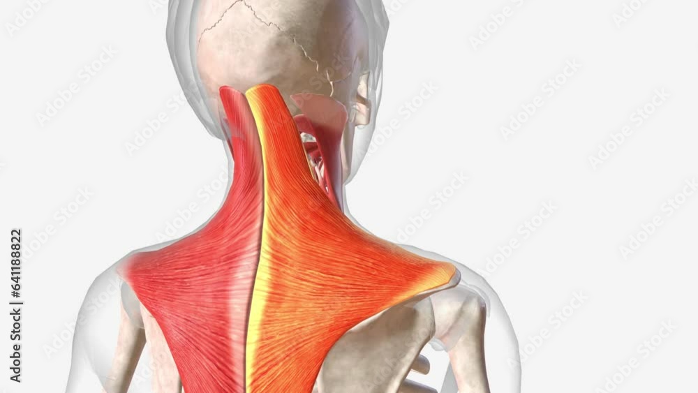 Trapezius myalgia (TM) is the complaint of pain, stiffness, and ...