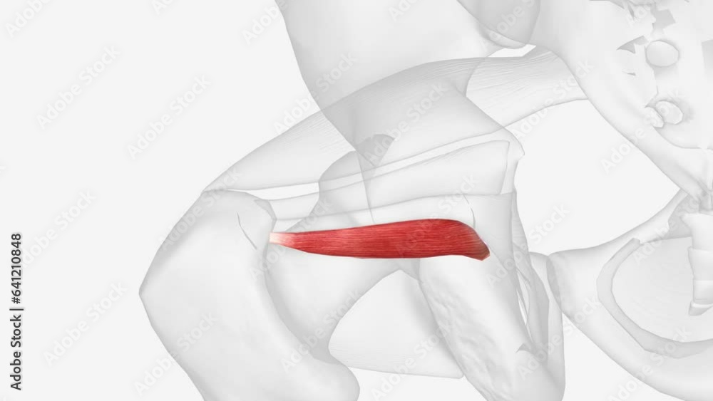 Inferior gemellus is a small, paired muscle located in the deep gluteal ...
