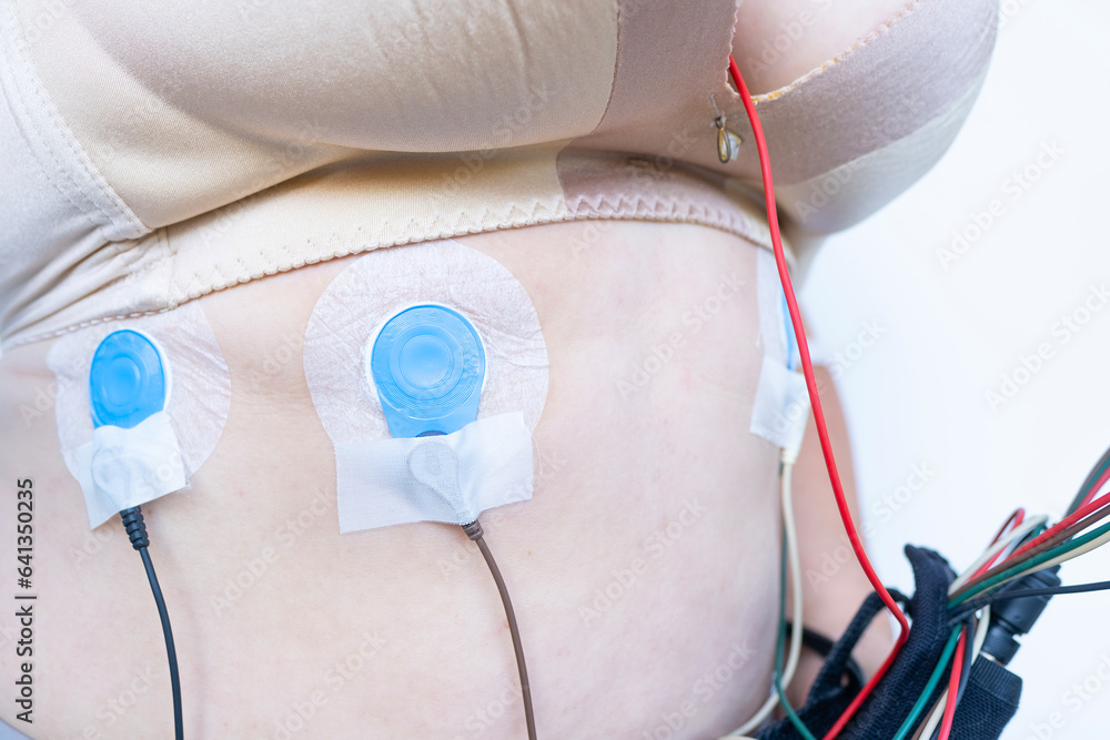 sensors on body for Holter monitoring, woman with Holter monitor daily ... sensors on body for Holter monitoring, woman with Holter monitor daily ...