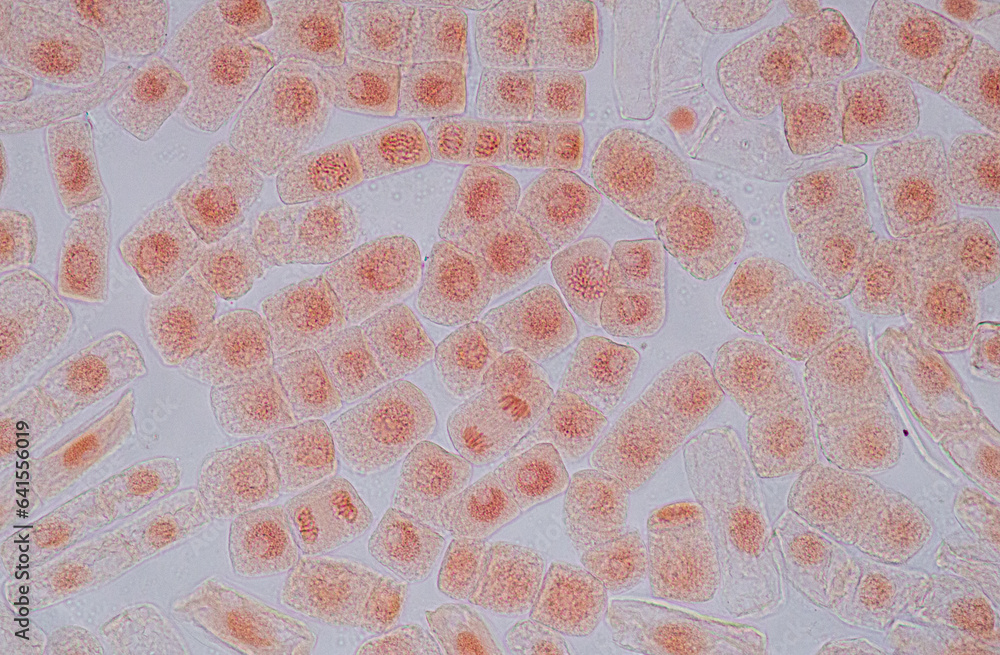 Mitosis cell in the Root tip of Onion under a microscope. Stock Photo ...