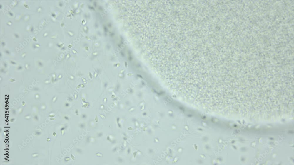 Sperm and ovule sea urchin Strongylocentrotus pallidus under microscope ...