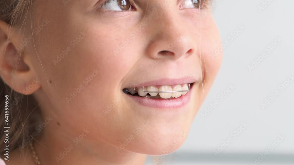 Children's teeth large with a cap. Bracket system on the teeth ...