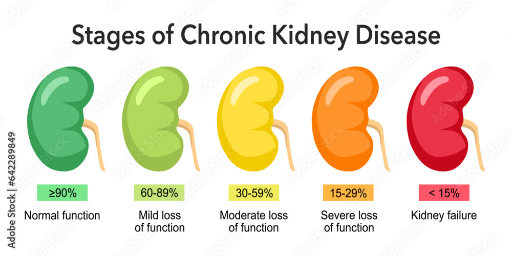 Chronic kidney disease. Stage of disease from normal and mildly ...
