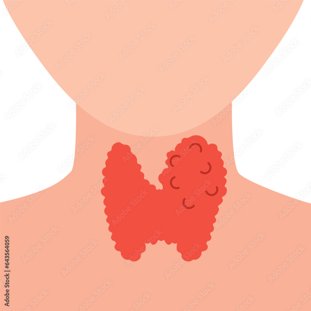Enlarged thyroid gland lobe icon. Faceless body silhouette. Thyroid ...