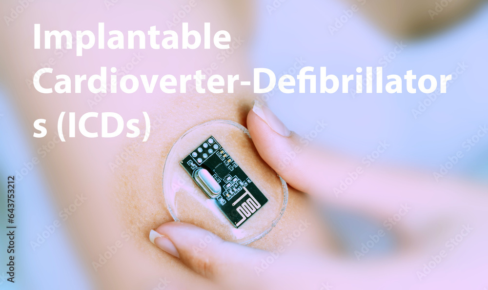 Implantable Cardioverter-Defibrillators (ICDs) Implantable Electronic ...
