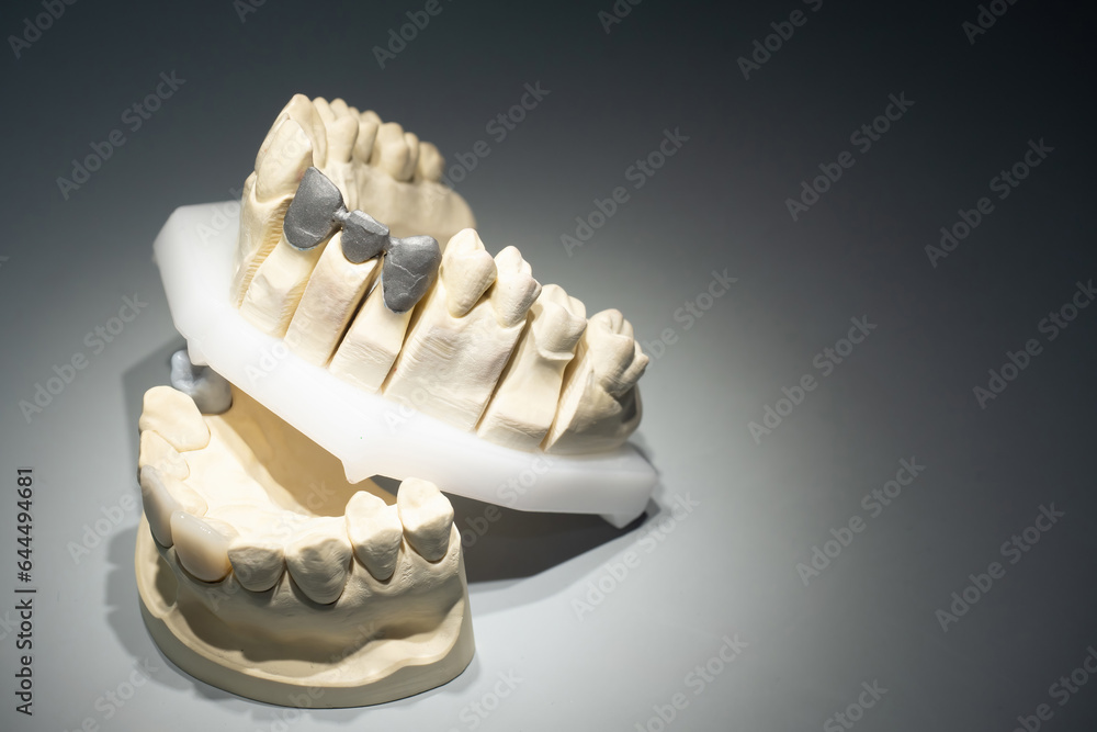 Models of human teeth. Dental visual aid. Teeth and gum model for ...