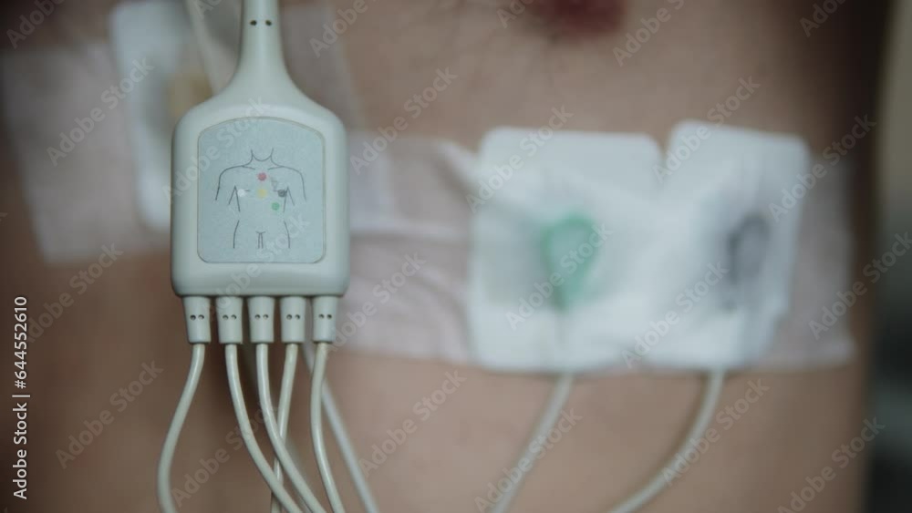 Splitter with wires, circuit and fixed sensors of medical cardio device ... Splitter with wires, circuit and fixed sensors of medical cardio device ...