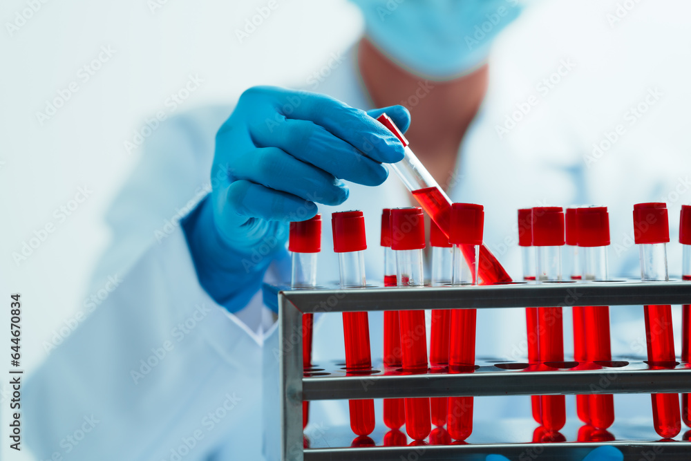 Close up dedicated hematology lab technician scrutinizing blood sample ...