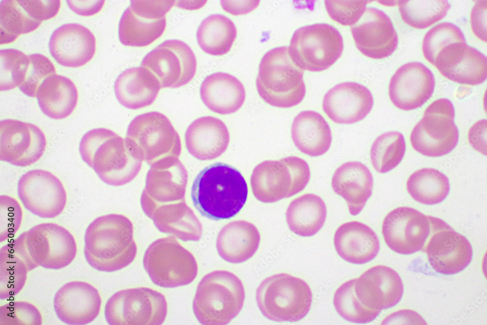 White blood cell in blood smear, analyze by microscope, original ...