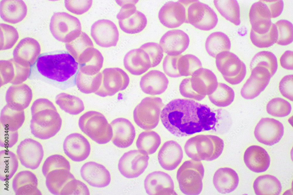 White blood cell in blood smear, analyze by microscope, original ...