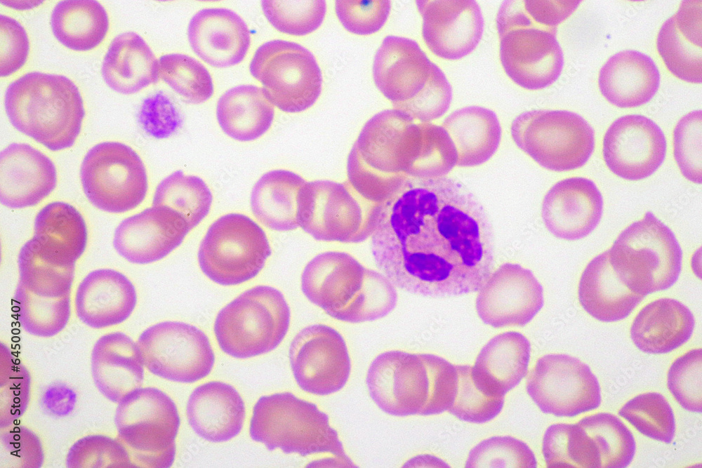 White blood cell in blood smear, analyze by microscope, original ...